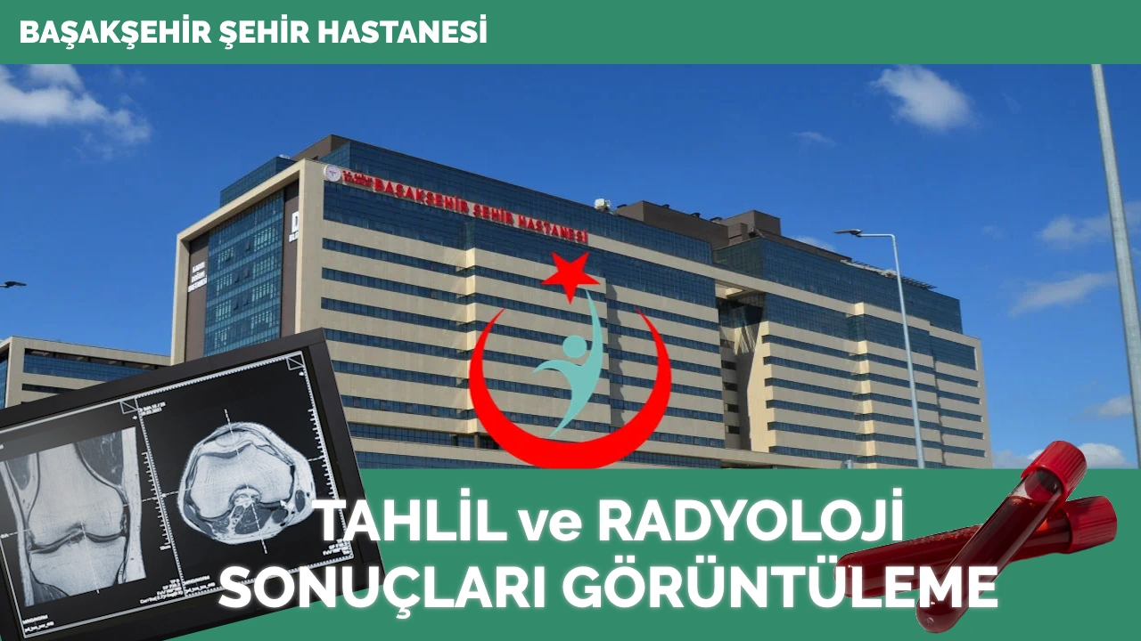 Başakşehir Çam ve Sakura Şehir Hastanesi Tahlil ve Radyoloji Sonuçları ...